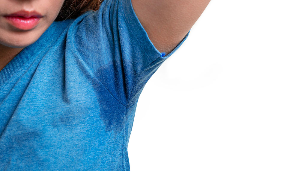 Botox for Sweating Treatment in Cincinnati, Ohio